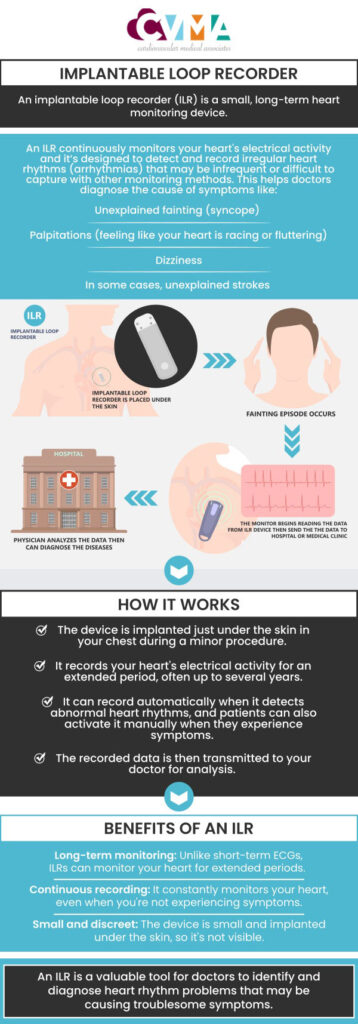 Implantable Loop Recorder Near Me in Downey, CA